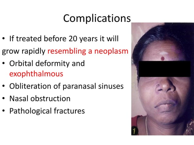 bone diseases I&II Dr Reham (1).pd vvvvf | PDF