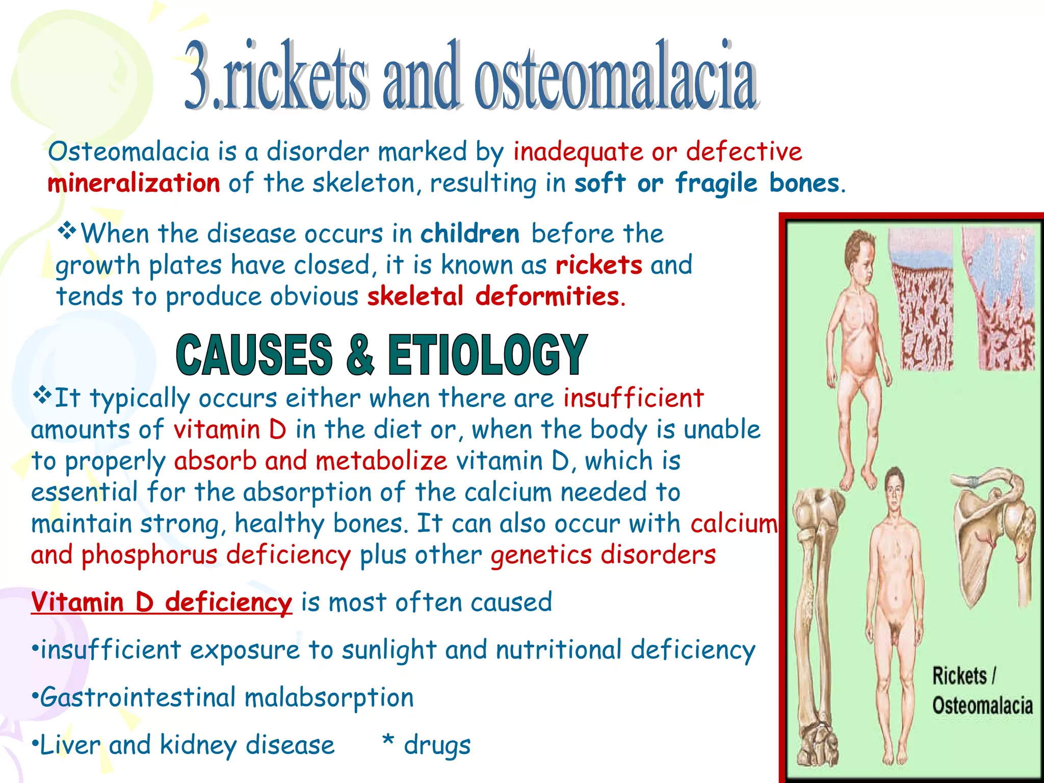 Bone disorders | PPT