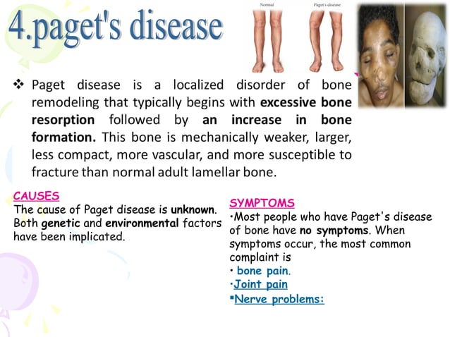 Bone disorders | PPT