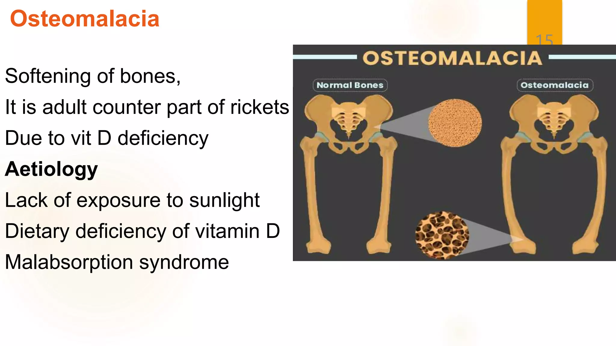 Bone disorders and management.pptx
