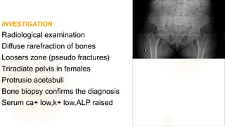 Bone disorders and management.pptx