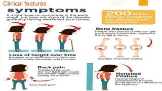 Bone disorders and management.pptx