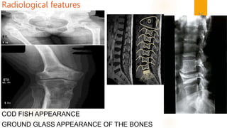 Bone disorders and management.pptx