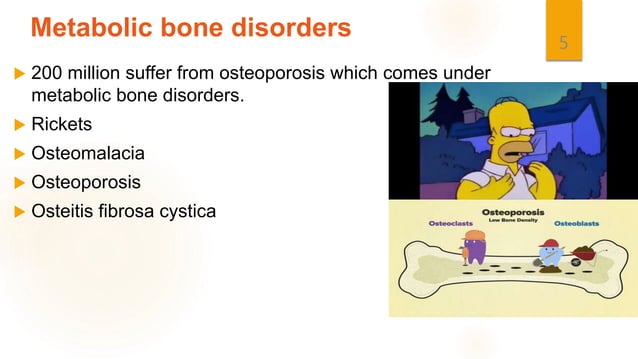 Bone disorders and management.pptx