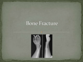 Bone fracture | PPTX