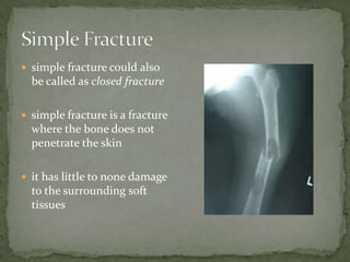 Bone fracture | PPT