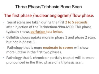 bone fracture.pptx
