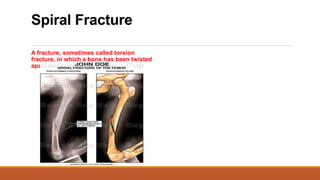 BONE FRACTURE.pptx