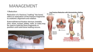BONE FRACTURE.pptx