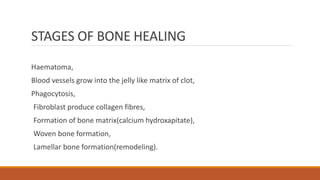 BONE FRACTURE.pptx