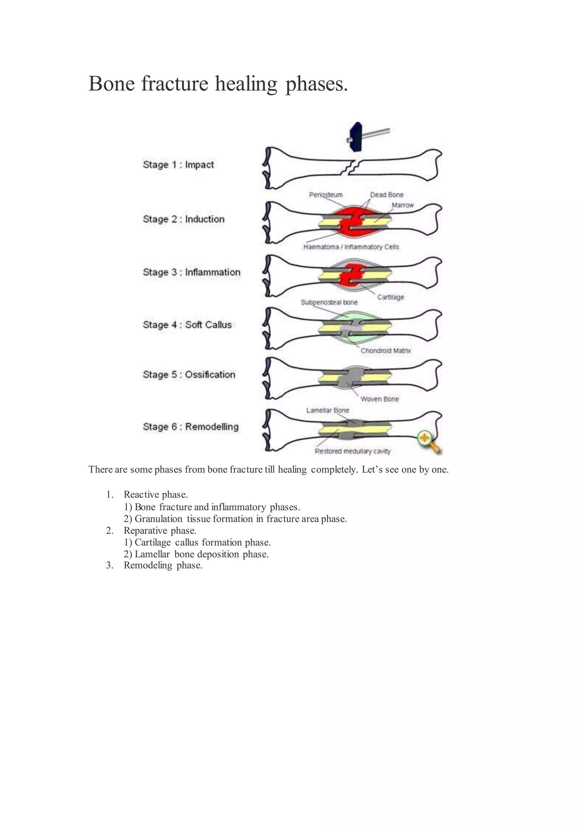 Bone fracture healing phases and standards www.bonedisease.info