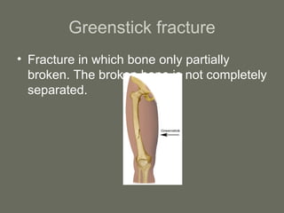 Bone Fractures | PPT