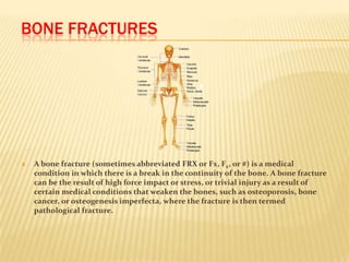 Bone Fractures | PPTX