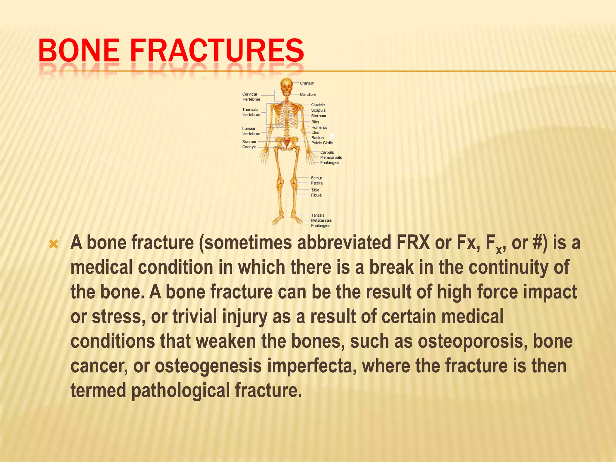 Bone Fractures | PPTX