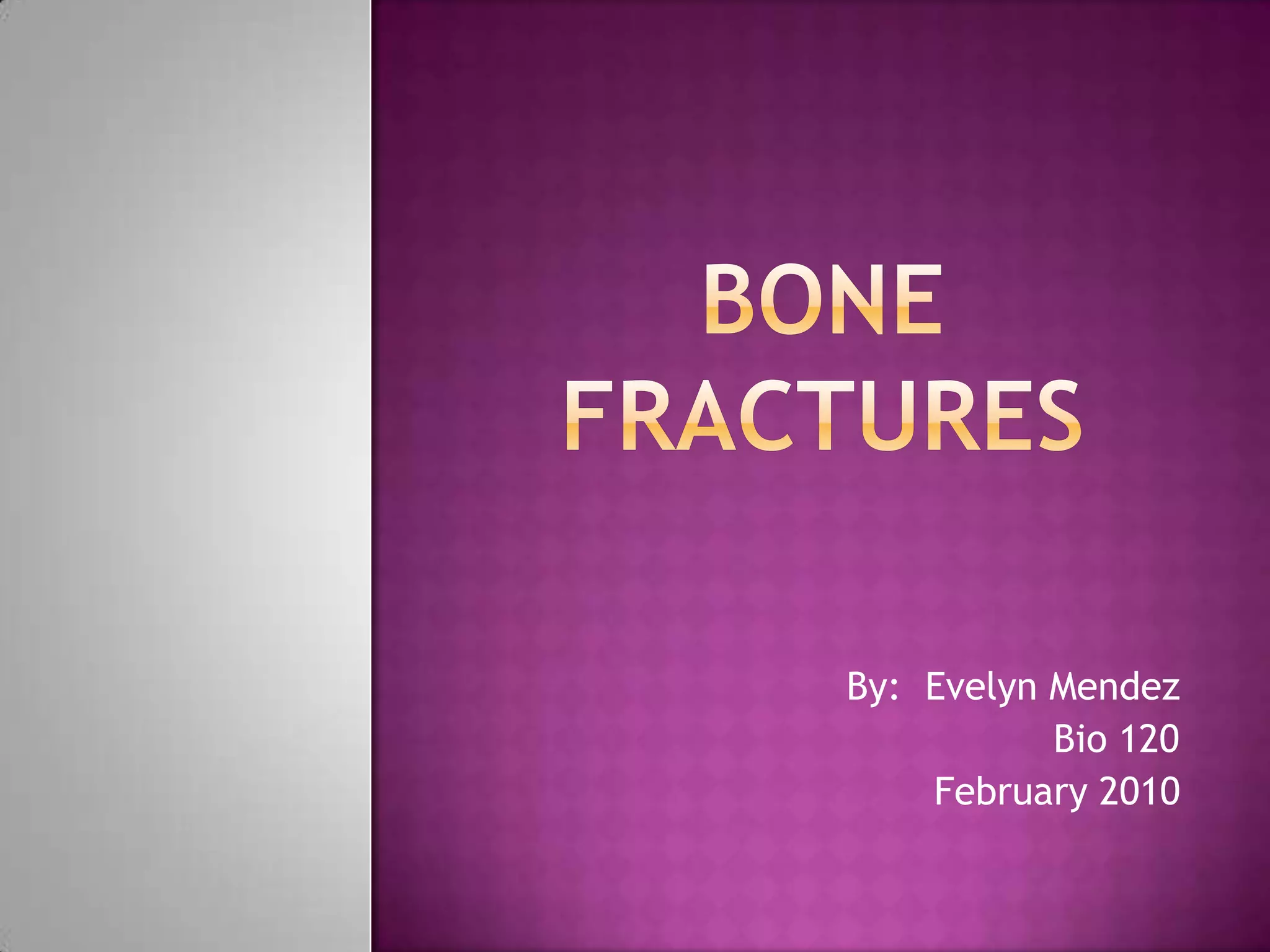 Bone Fractures | PPTX