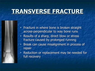 Bone fractures | PPT