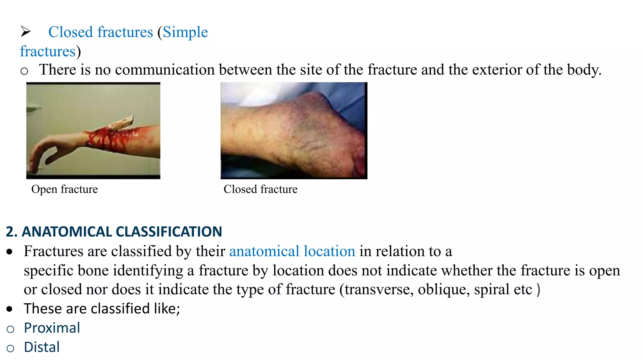 BONE FRACTURES.pptx