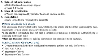 BONE FRACTURES.pptx