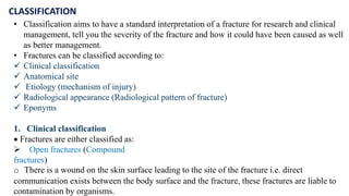 BONE FRACTURES.pptx