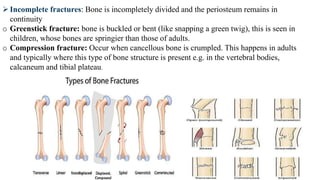 BONE FRACTURES.pptx
