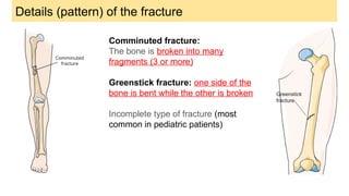 Bone Fractures in adults and children. types of bone fracture and ...