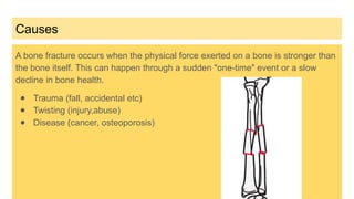 Bone Fractures in adults and children. types of bone fracture and ...
