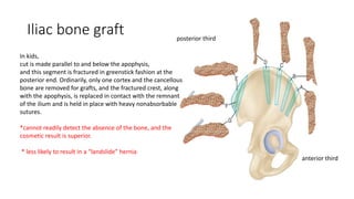 Bone Graft=============== | PPTX