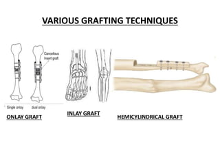 Bone grafting | PPT