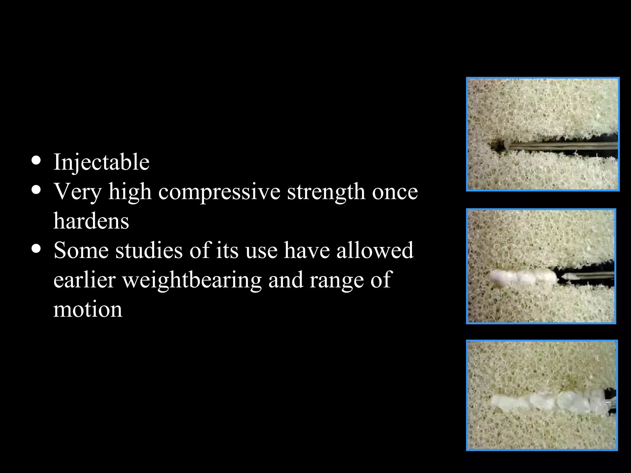 Bone grafting and bone graft substitutes | PPT