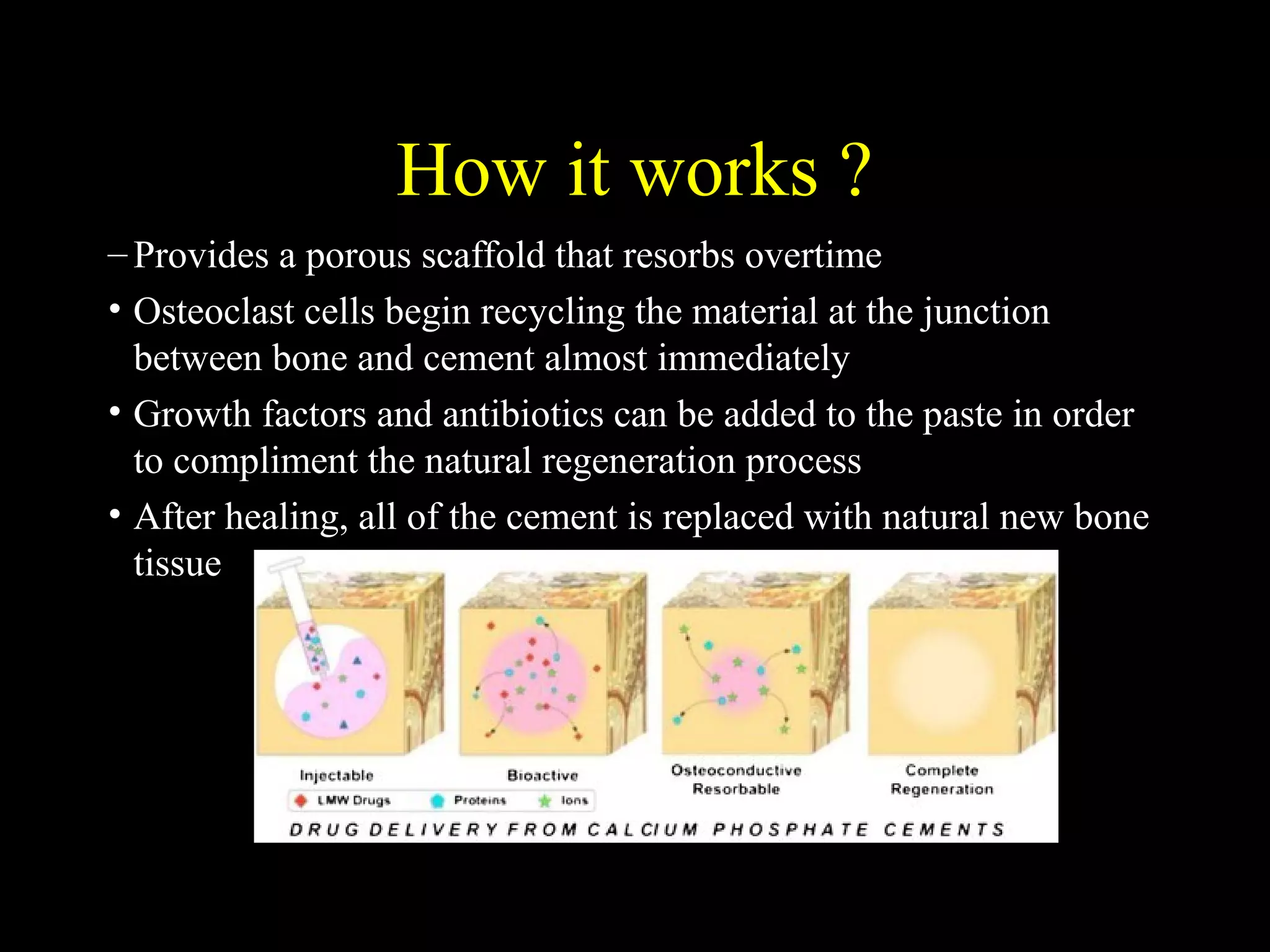 Bone grafting and bone graft substitutes | PPT