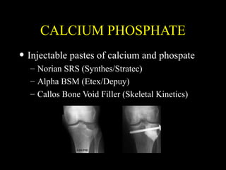Bone grafting and bone graft substitutes | PPT