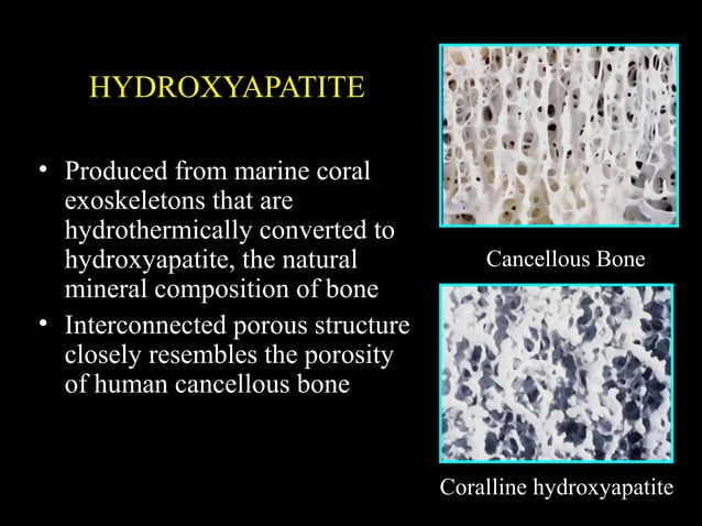 Bone grafting and bone graft substitutes | PPT