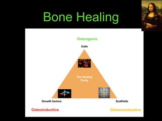 Bone grafting Options and Substitutes | PPT