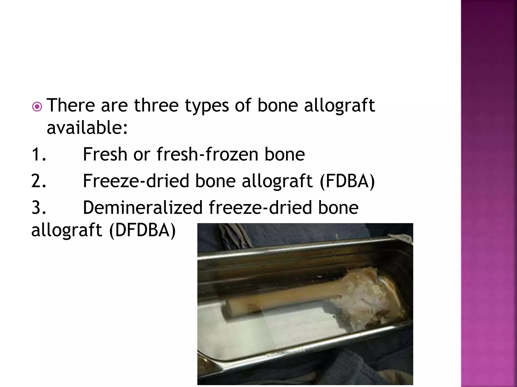 Bone grafts | PPTX