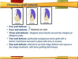 Bone grafts | PPTX