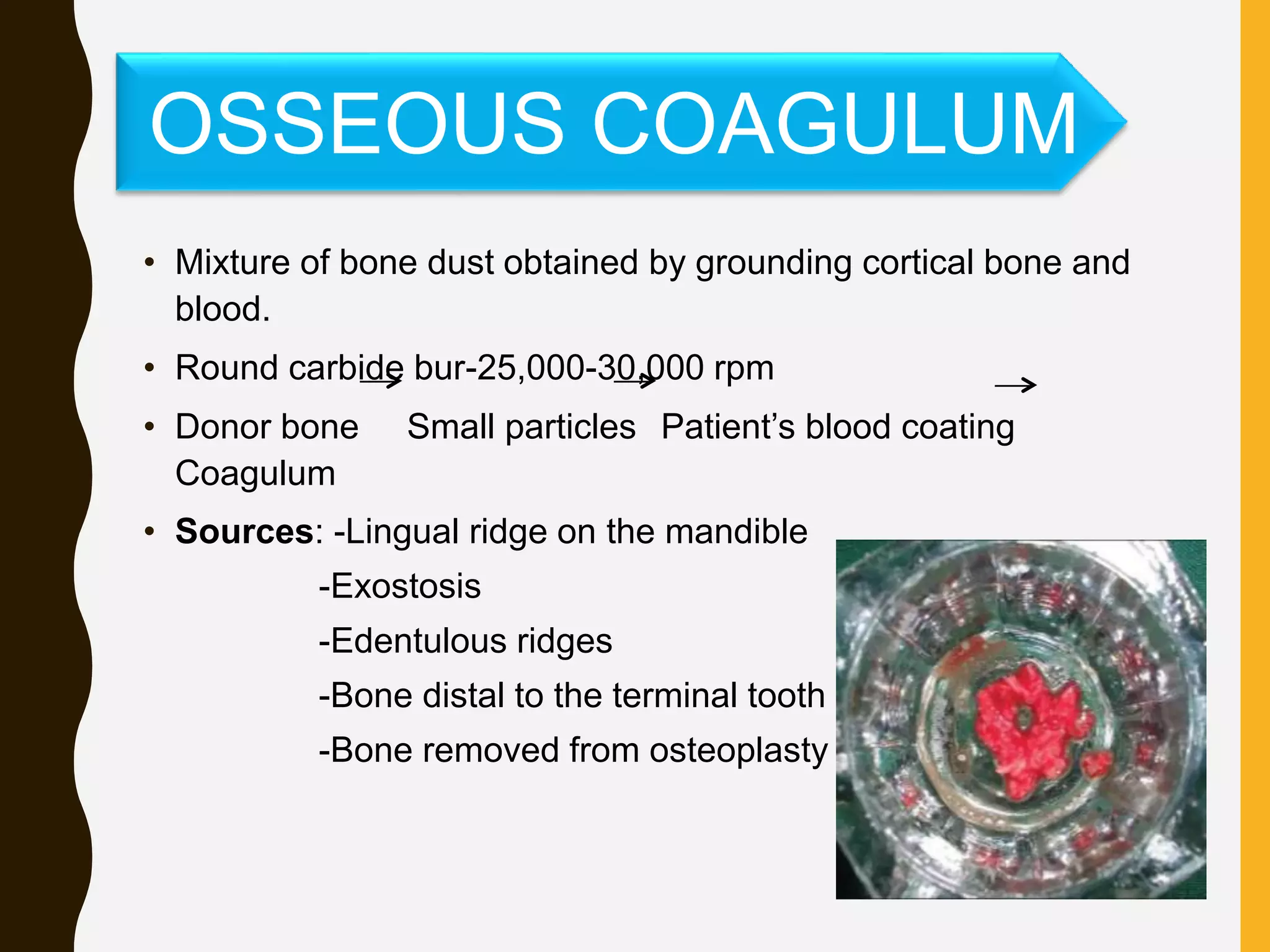 Bone grafts in dentistry | PPTX