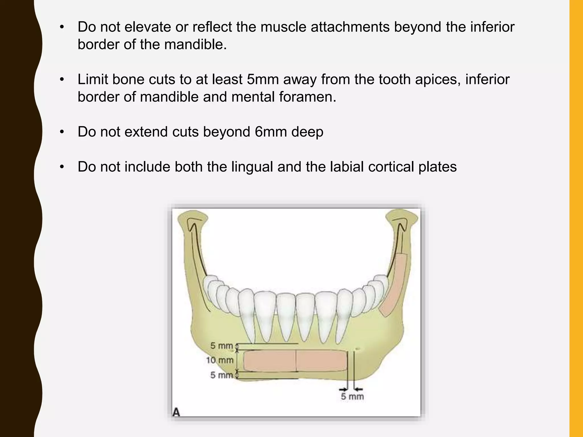 Bone grafts in dentistry | PPTX
