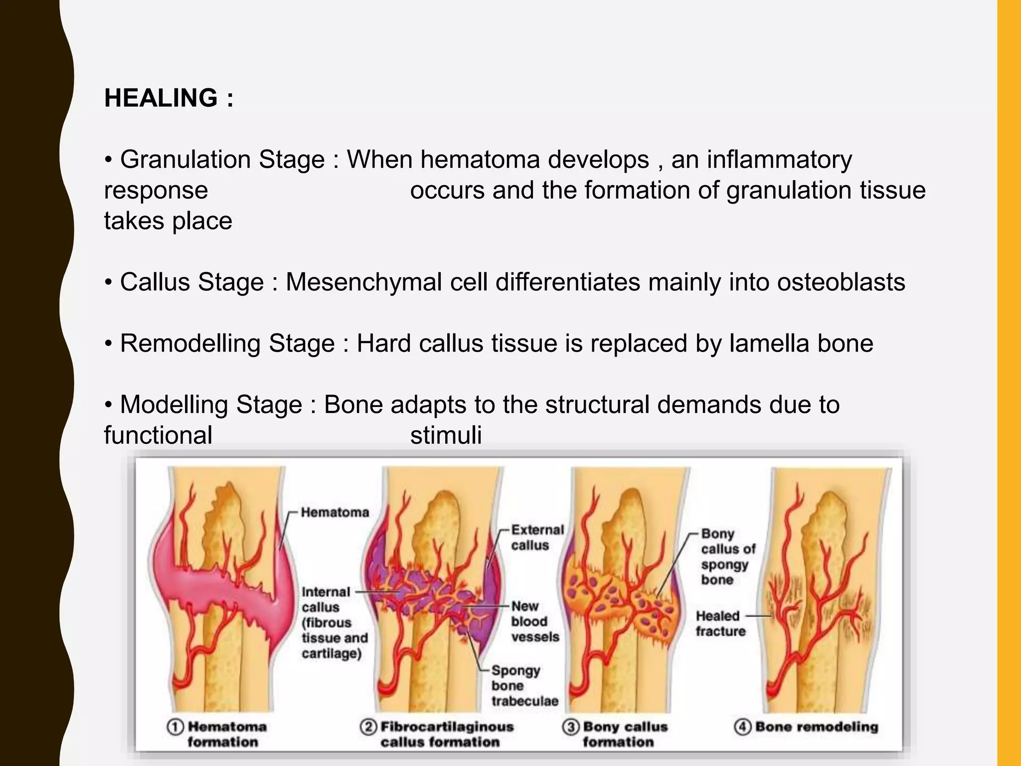 Bone grafts in dentistry | PPTX