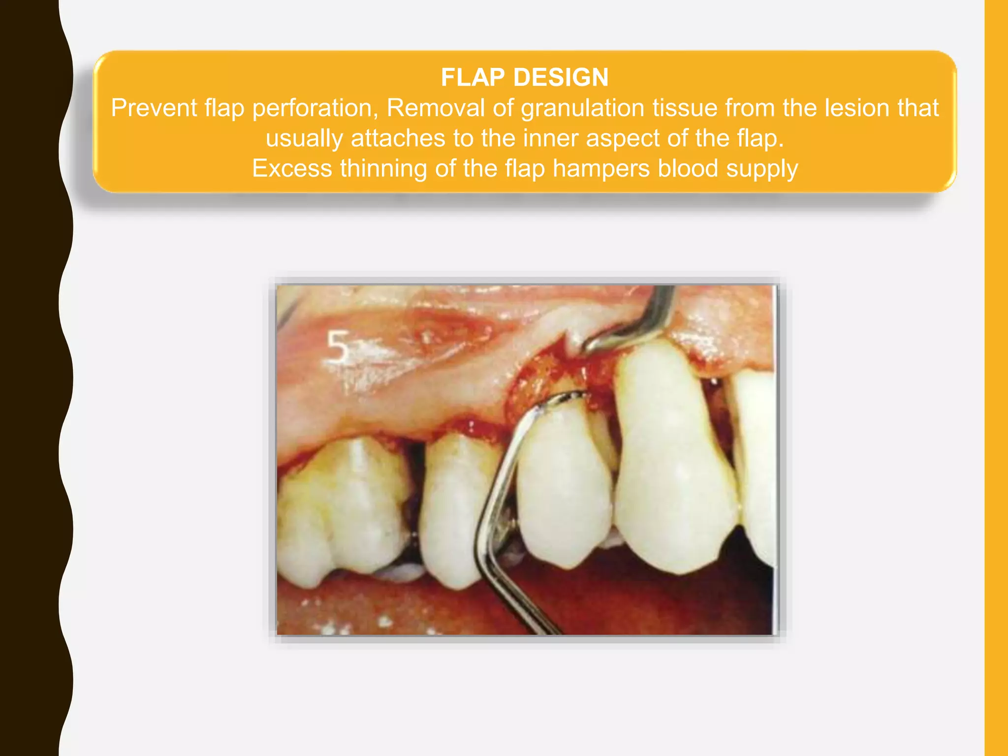 Bone grafts in dentistry | PPTX