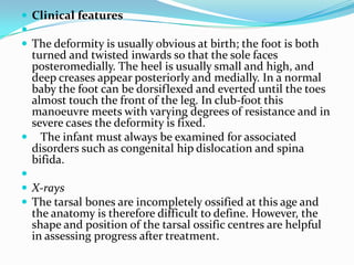 orthopedics.Bone grafts and club foot.(dr.omer barawe) | PPT