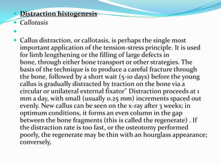 orthopedics.Bone grafts and club foot.(dr.omer barawe) | PPT