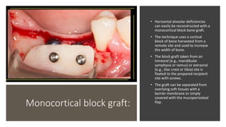 Bone grafts and growth factors implantology | PPTX