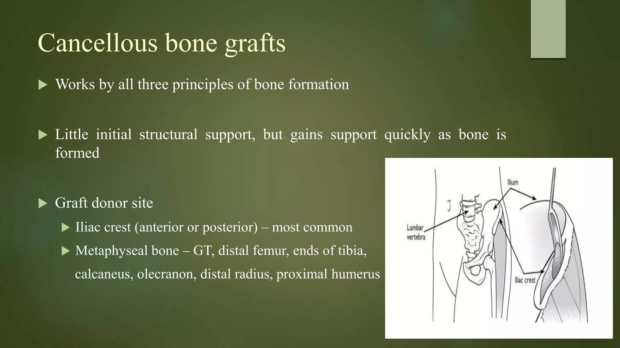 Bone grafts and it's substitutes - Dr. Sachin M | PPT