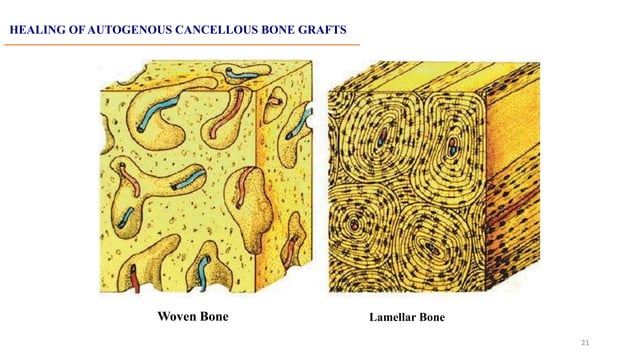 Bone grafts and substitutes | PPT