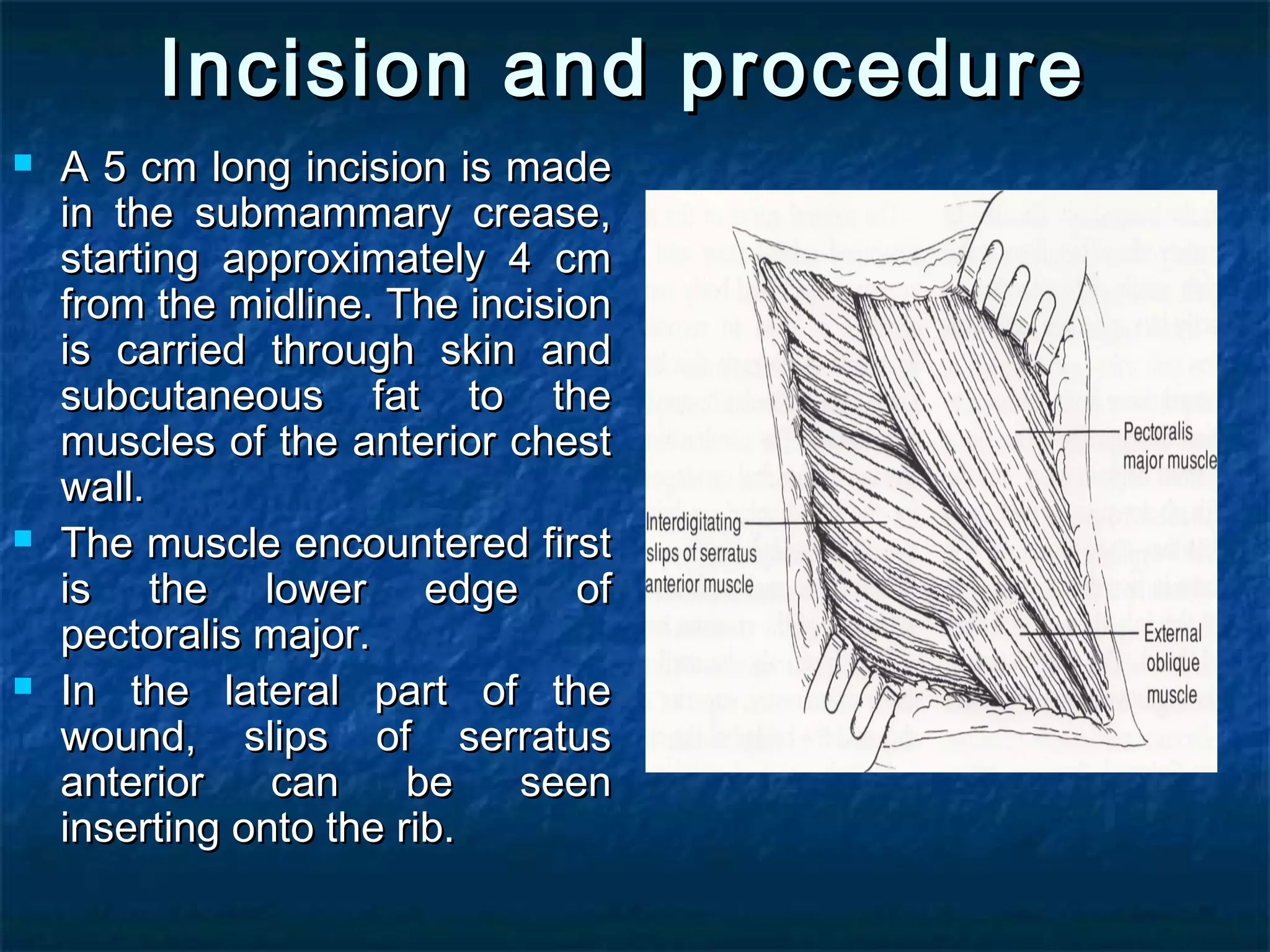 Bone grafts in oral surgery | PPT