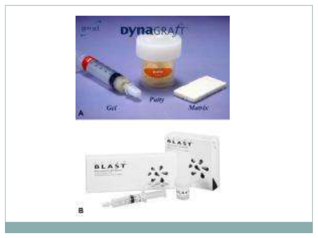 Bone graft substitutes | PPTX