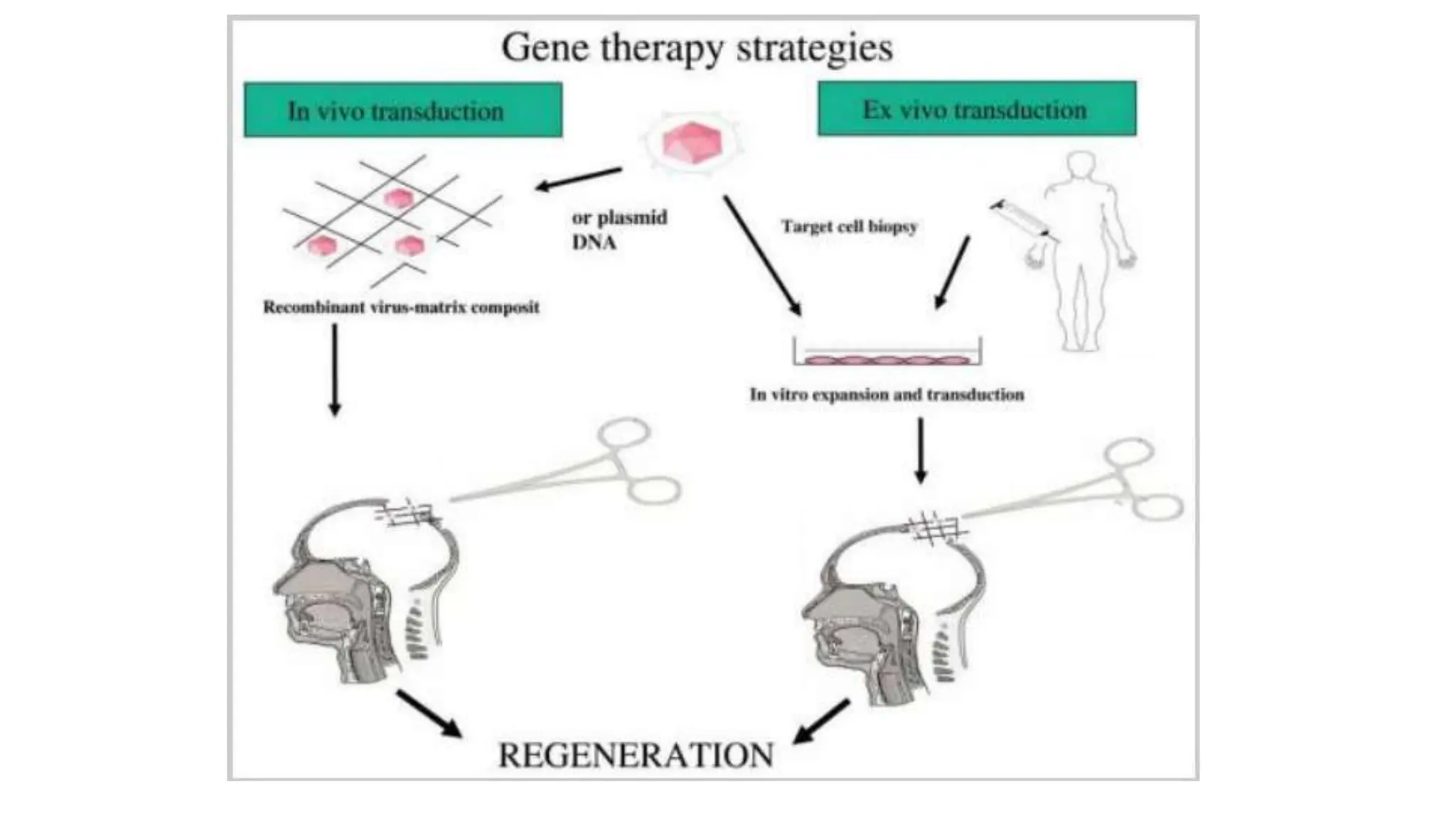 Bone Regeneration Gene therapy approaches.pptx
