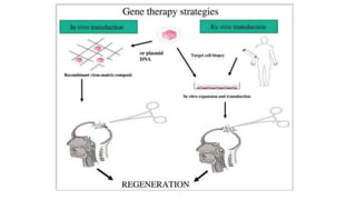 Bone Regeneration Gene therapy approaches.pptx