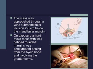 Bone haemangioma of hyoid bone | PPT