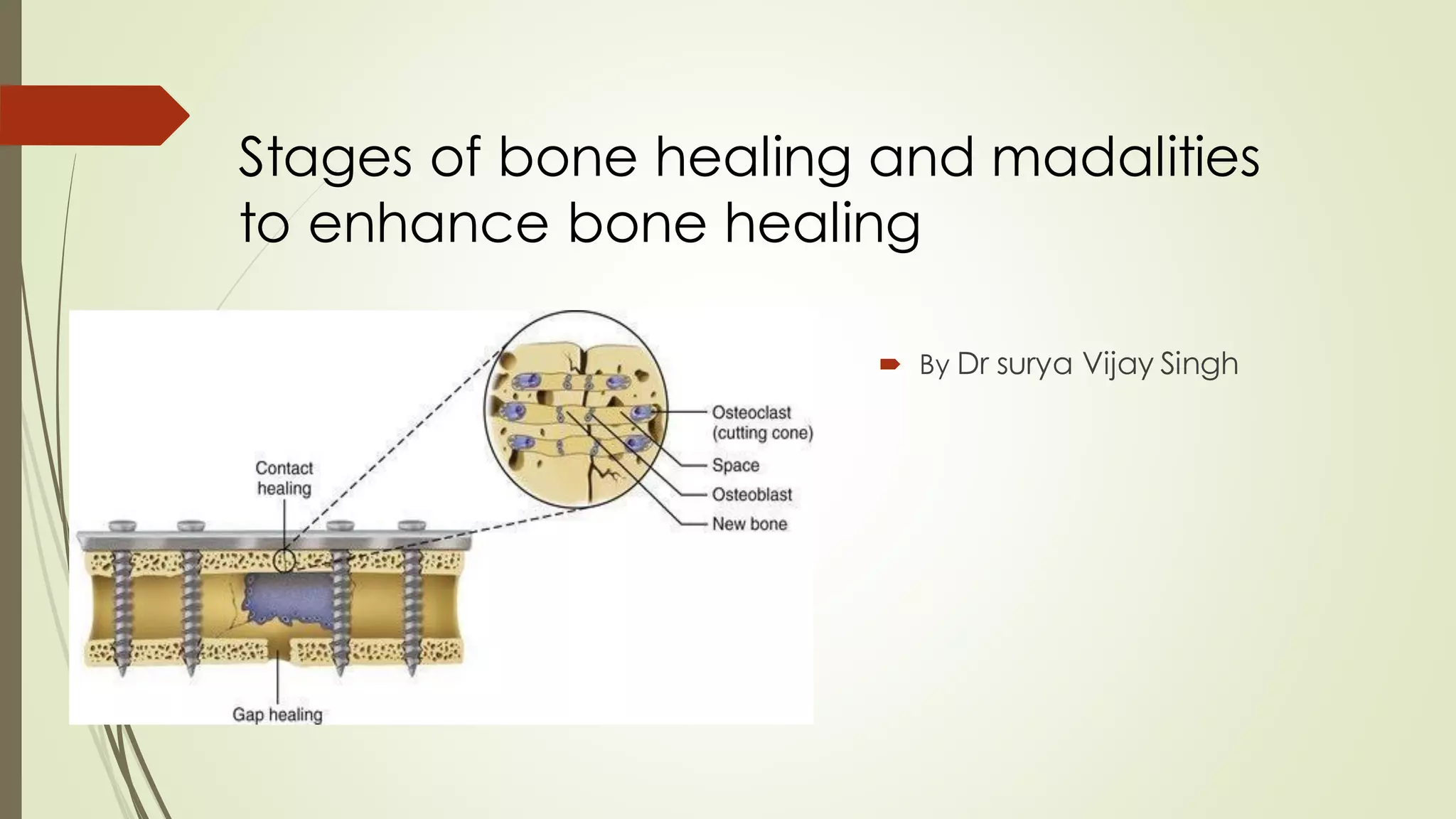 Stages of Bone healing and madalities to enhance bone healing | PDF